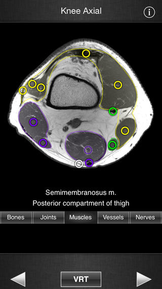 Lower Extremity Muscle Anatomy Axial Plane